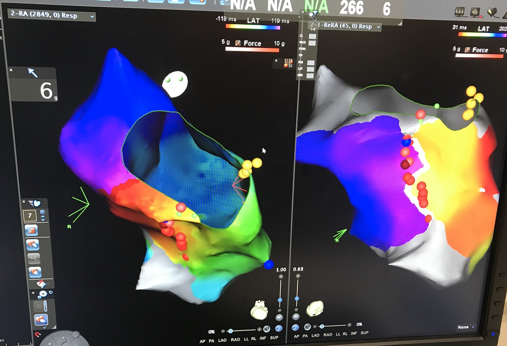 Clinical Cardiac Electrophysiology Fellowship | Cooper Medical Education Clinical Cardiac Electrophysiology Fellowship | Cooper Medical Education